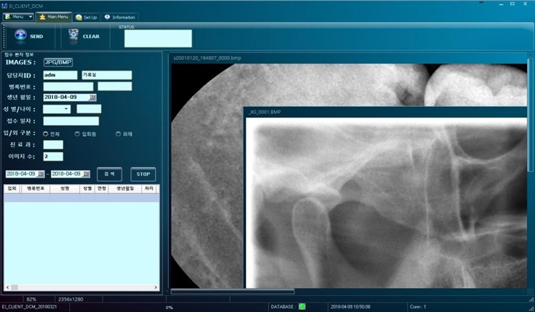 프리케어 솔루션